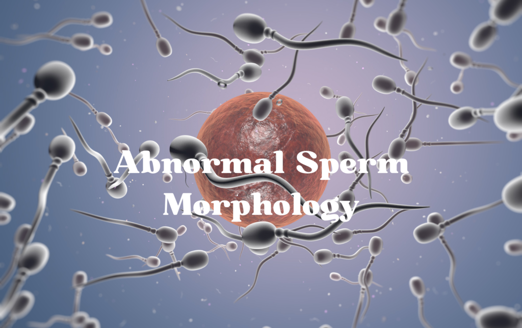 Abnormal Sperm Morphology - AndroOne - Sexologist and Andrologist In ... Abnormal Sperm Morphology - AndroOne - Sexologist and Andrologist In ...